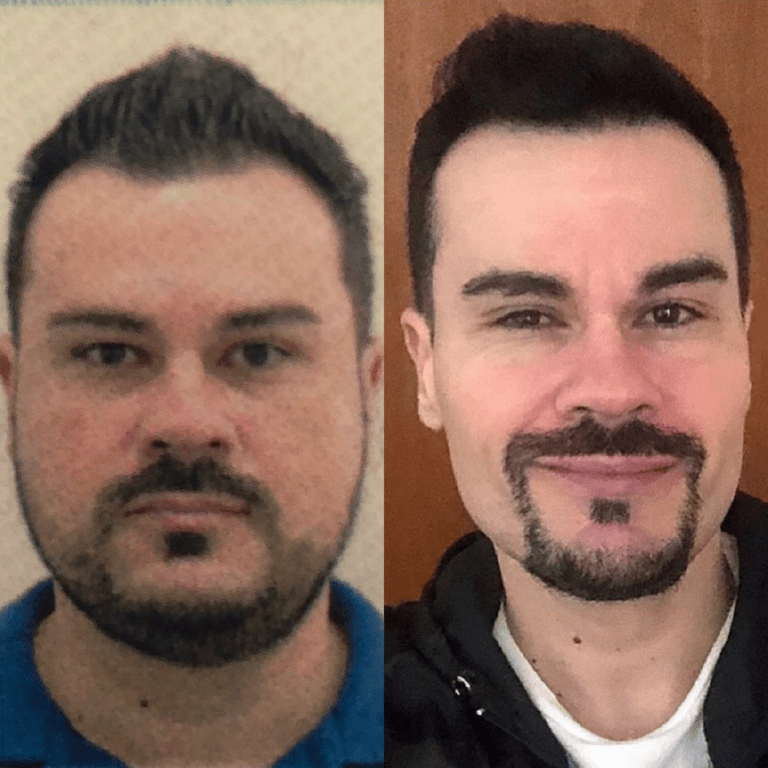 Jaison, 41 - The Lion Diet